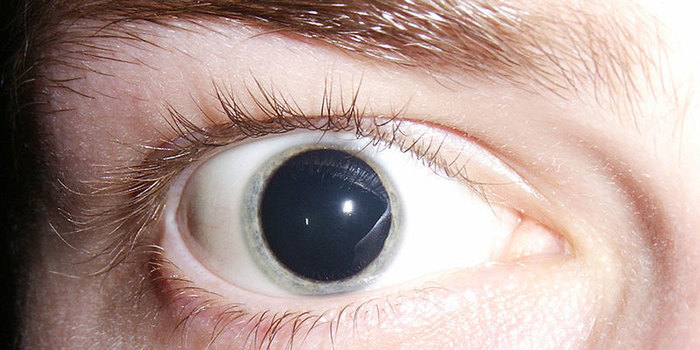 Estos son los efectos del LSD en tu cuerpo