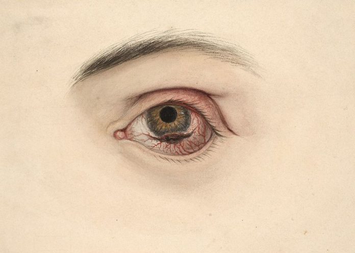 Estos son los síntomas del cáncer en el ojo Merca2