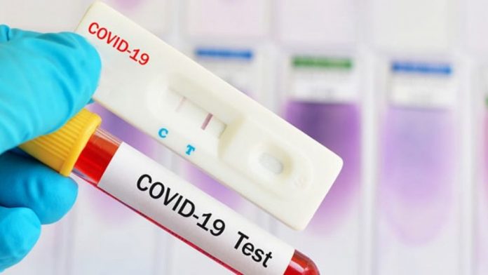 Boom de test de Covid-19: estos son los tipos de pruebas y precios